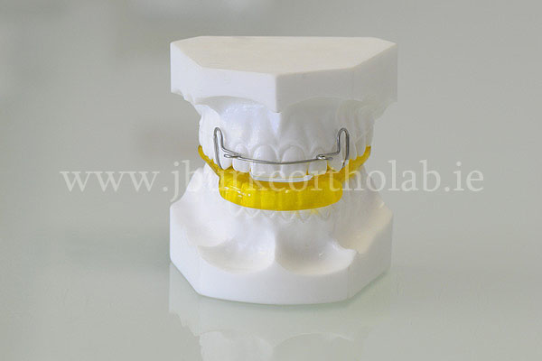 Activator appliance images | Activator , functional appliance in ...